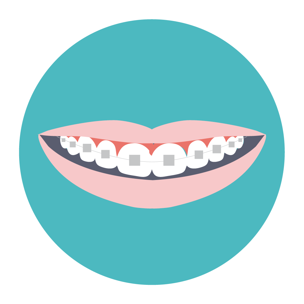 Orthodontie - Centre dentaire et d'orthodontie de Paris