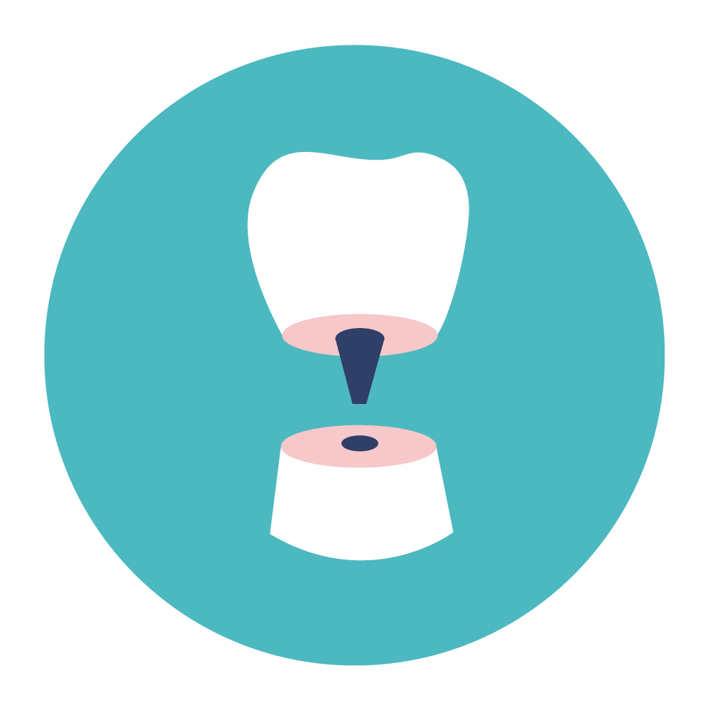 Prothèses dentaires - Centre dentaire et d'orthodontie de Paris